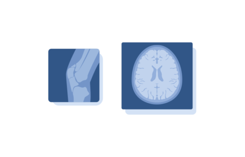Passer une IRM à Libourne - IRM du Libournais